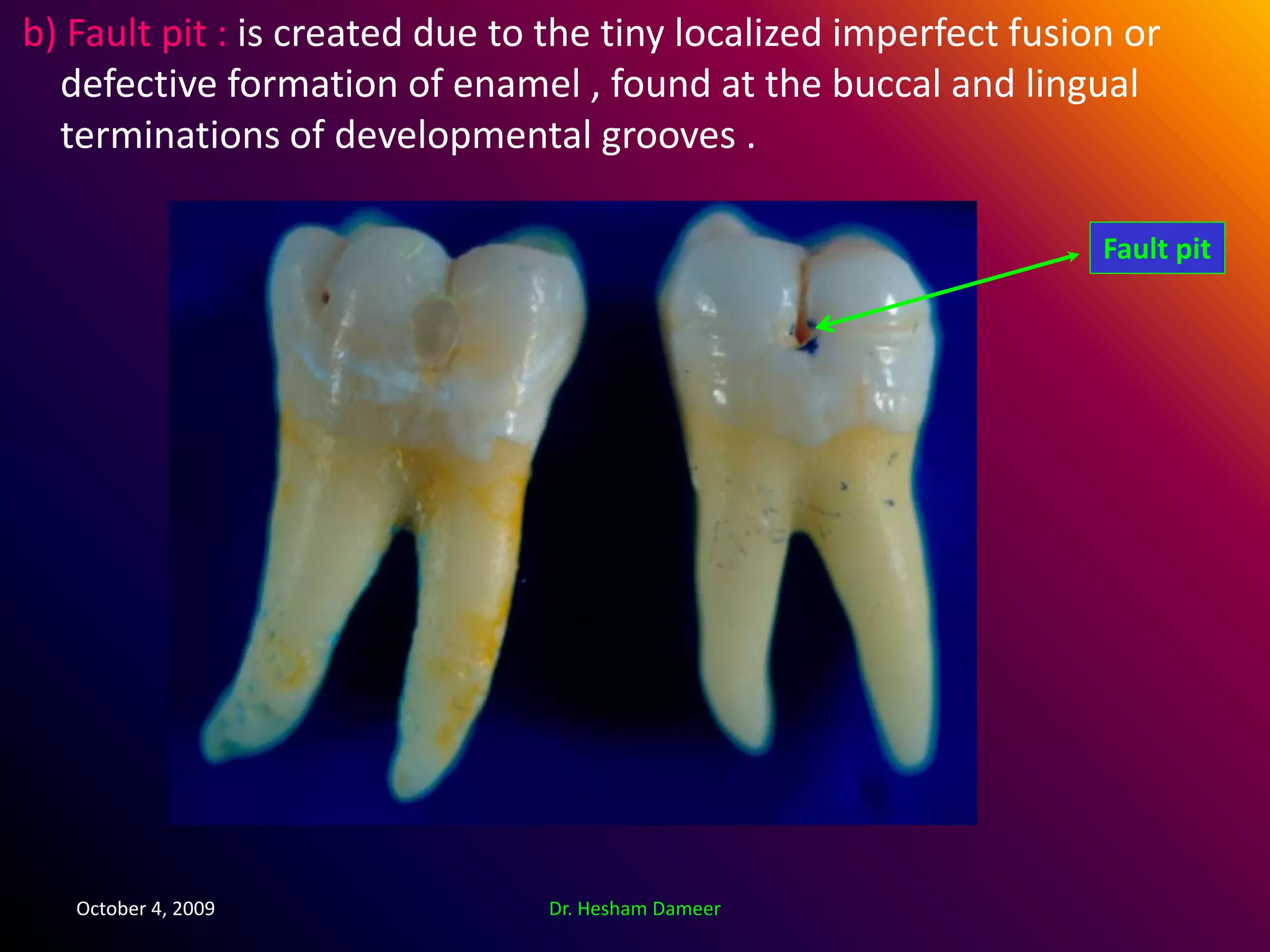 Anatomical landmarks of the crown | PPTX