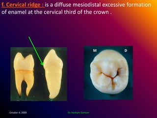 Anatomical landmarks of the crown | PPTX