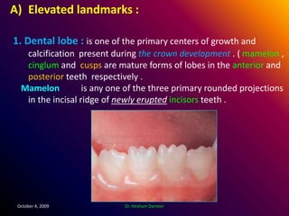 Anatomical landmarks of the crown | PPTX