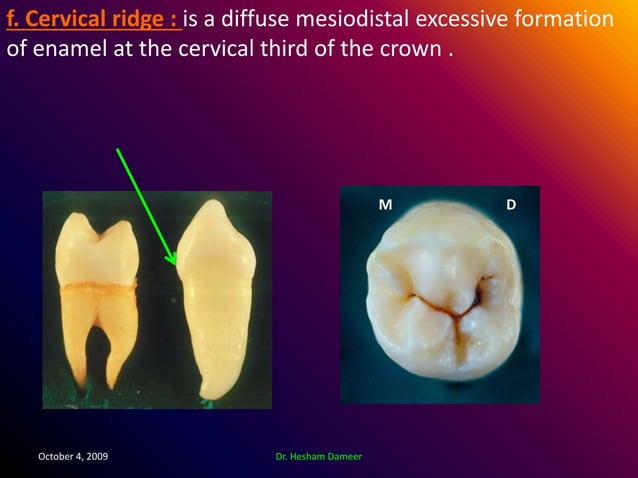 Anatomical landmarks of the crown