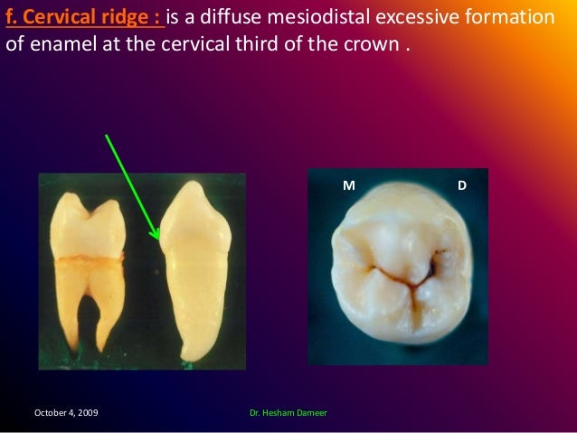 Anatomical landmarks of the crown