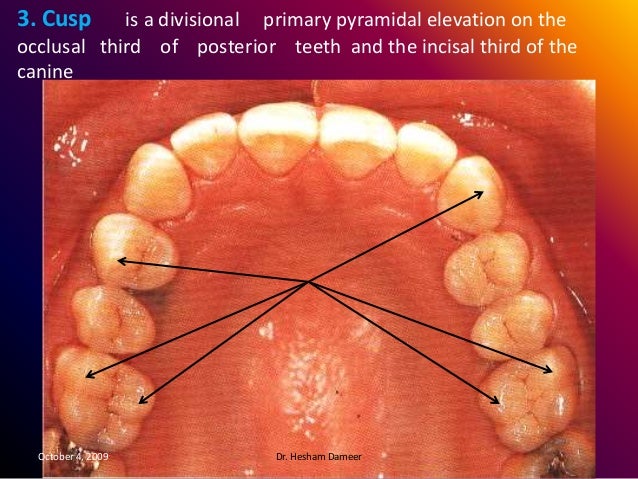 Anatomical landmarks of the crown