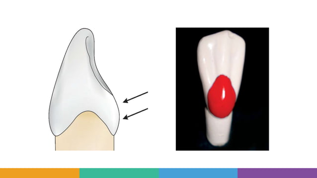 Anatomical Landmarks of tooth.pptx | Dental Health | Diseases and ...