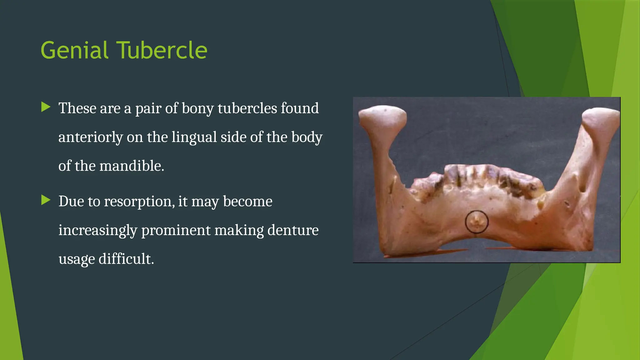 anatomical landmarks dentsl pedagogy.pptx