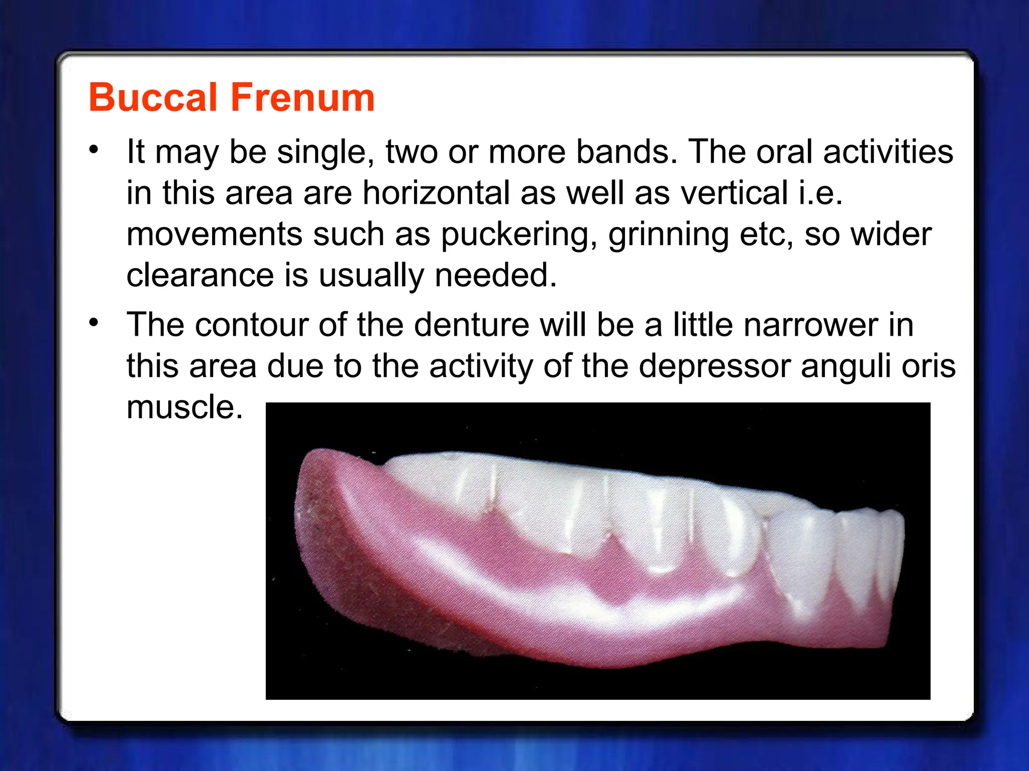 ANATOMICAL LANDMARKS RELATED TO COMPLETE DENTURES1.ppt