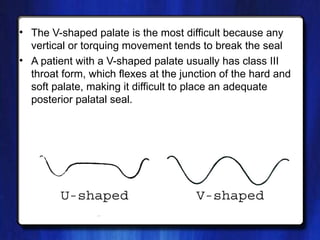 ANATOMICAL LANDMARKS RELATED TO COMPLETE DENTURES1.ppt