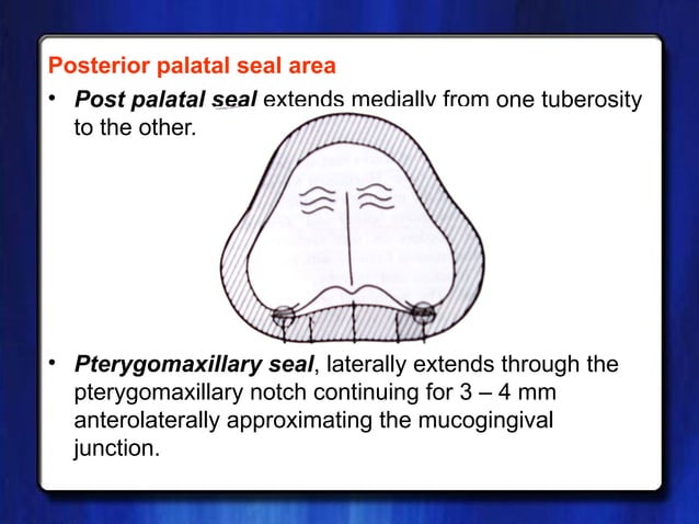 ANATOMICAL LANDMARKS RELATED TO COMPLETE DENTURES1.ppt