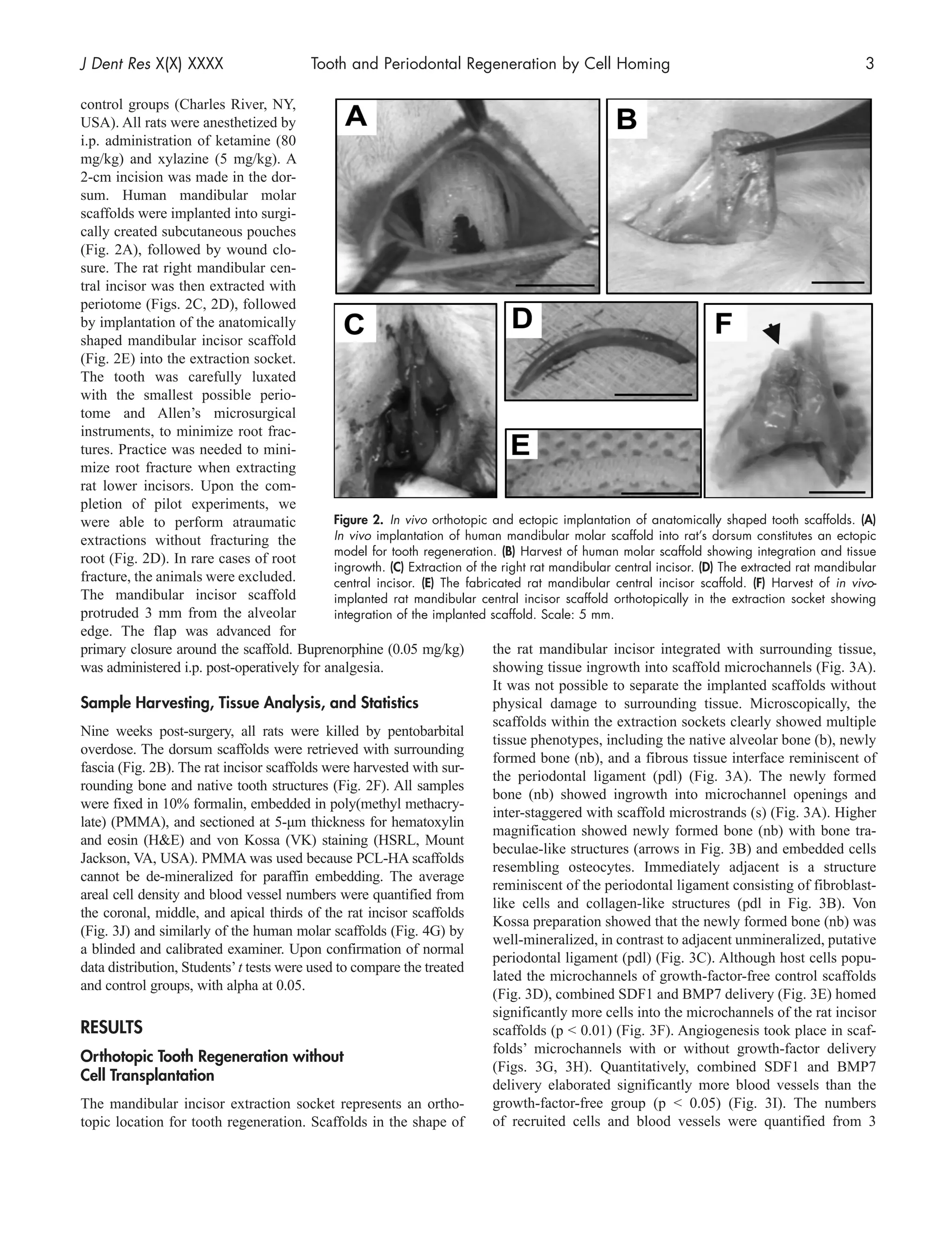 Anatomically shaped tooth and periodontal regeneration by cell homing | PDF
