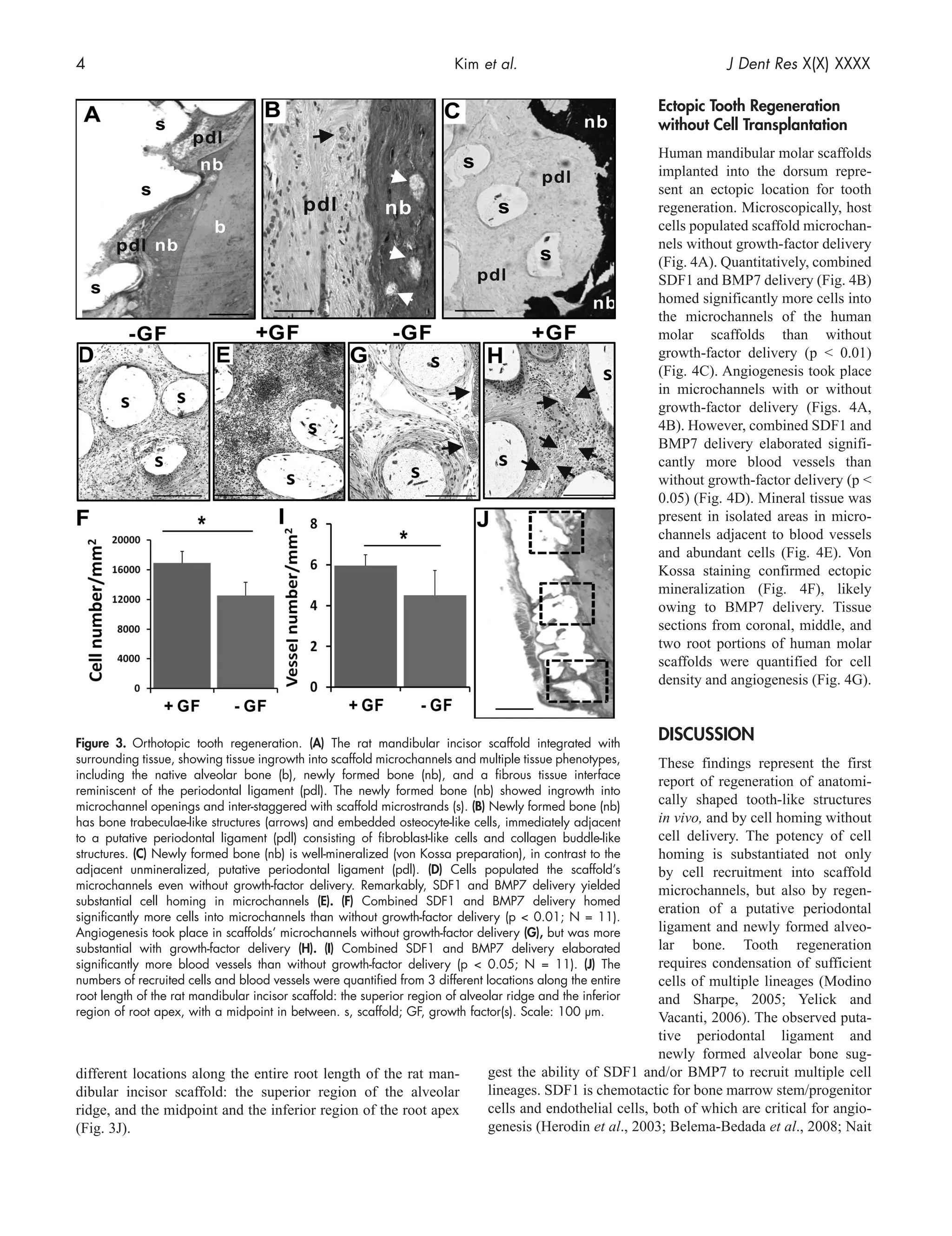 Anatomically shaped tooth and periodontal regeneration by cell homing | PDF