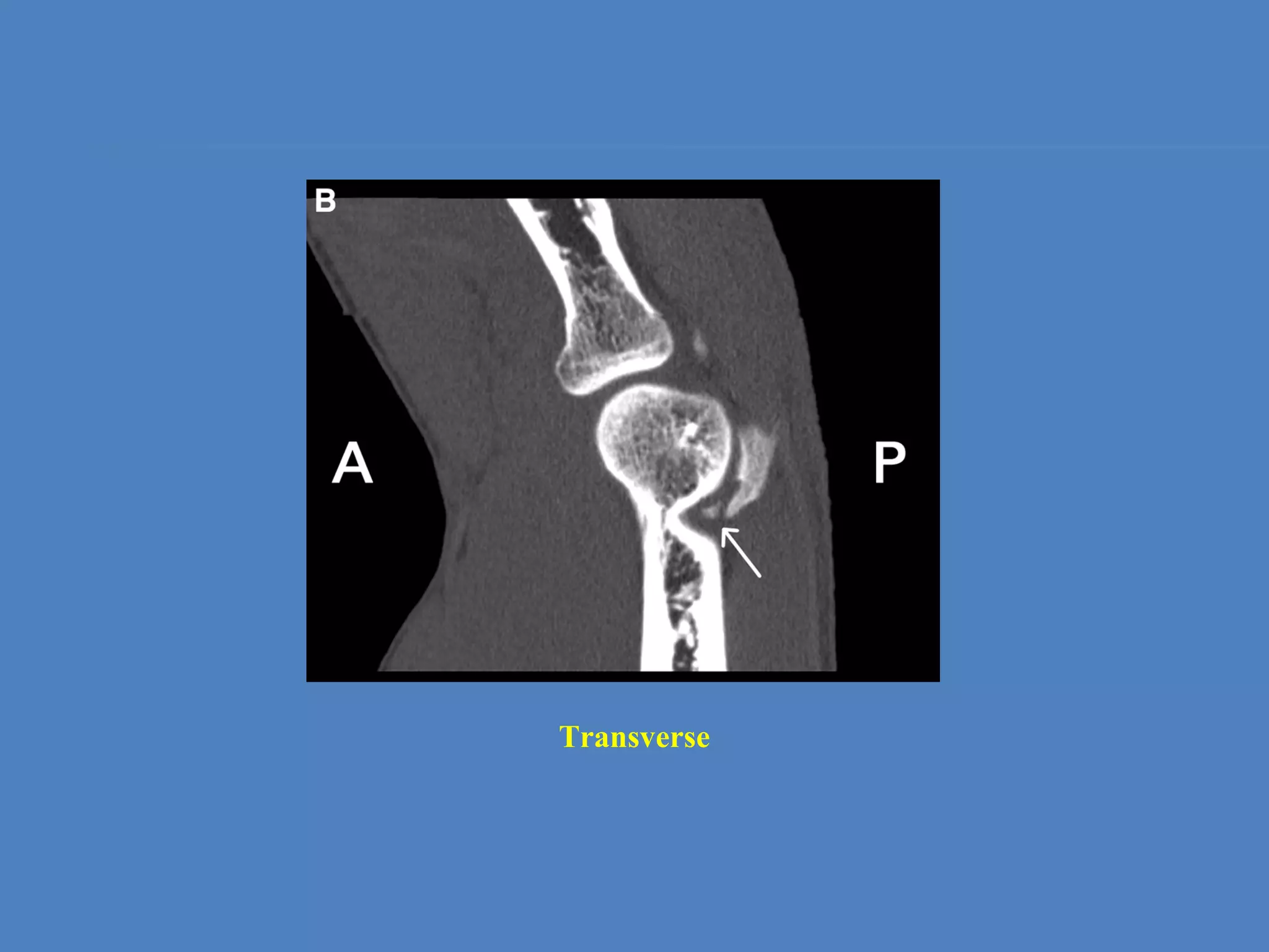 Anatomical Position and Basic Movements | PPT