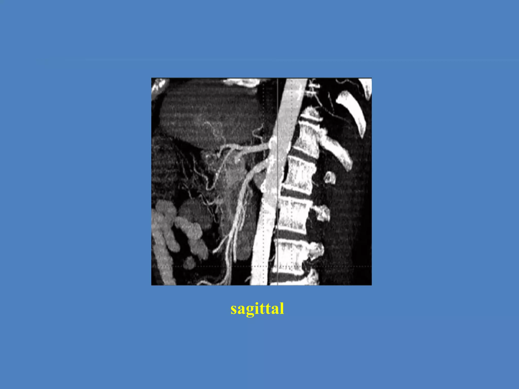 Anatomical Position and Basic Movements | PPT