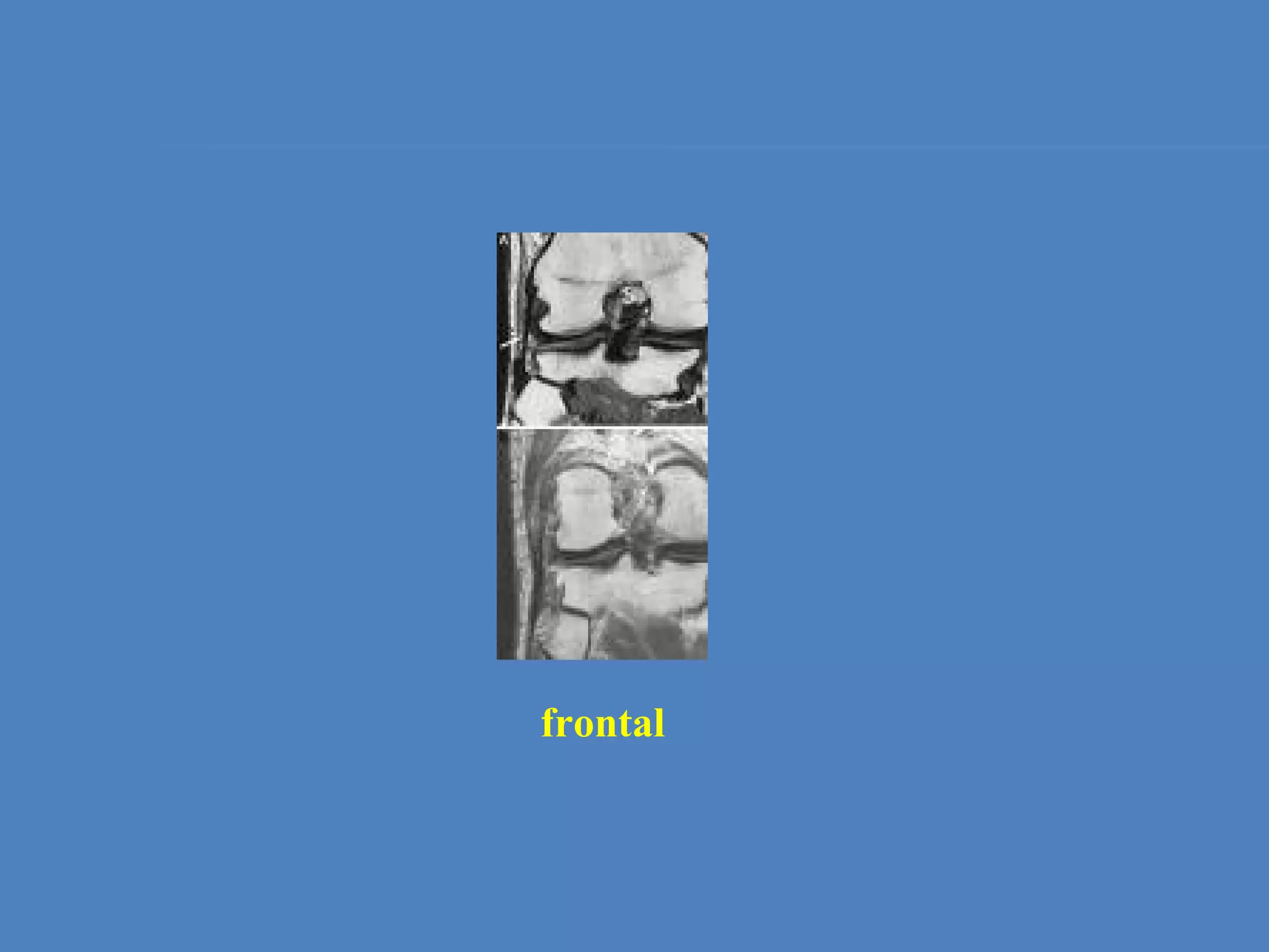 Anatomical Position and Basic Movements | PPT