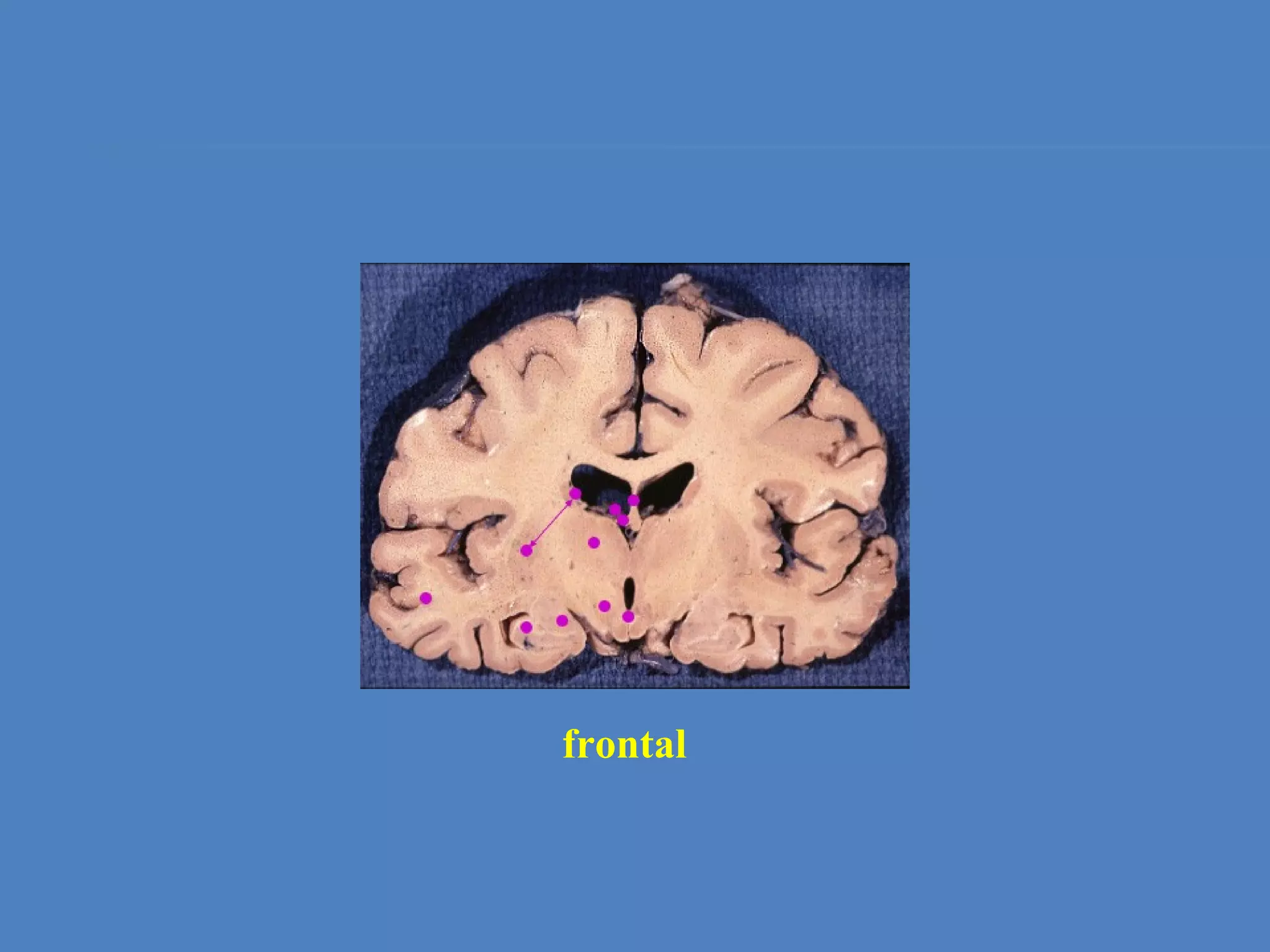 Anatomical Position and Basic Movements | PPT