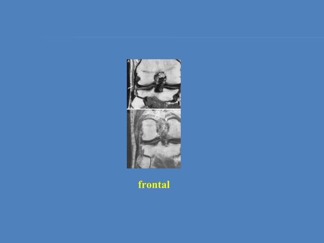 Anatomical Position and Basic Movements | PPT