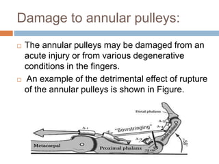 ANATOMICAL PULLEYS.ppt