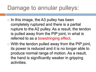 ANATOMICAL PULLEYS.ppt