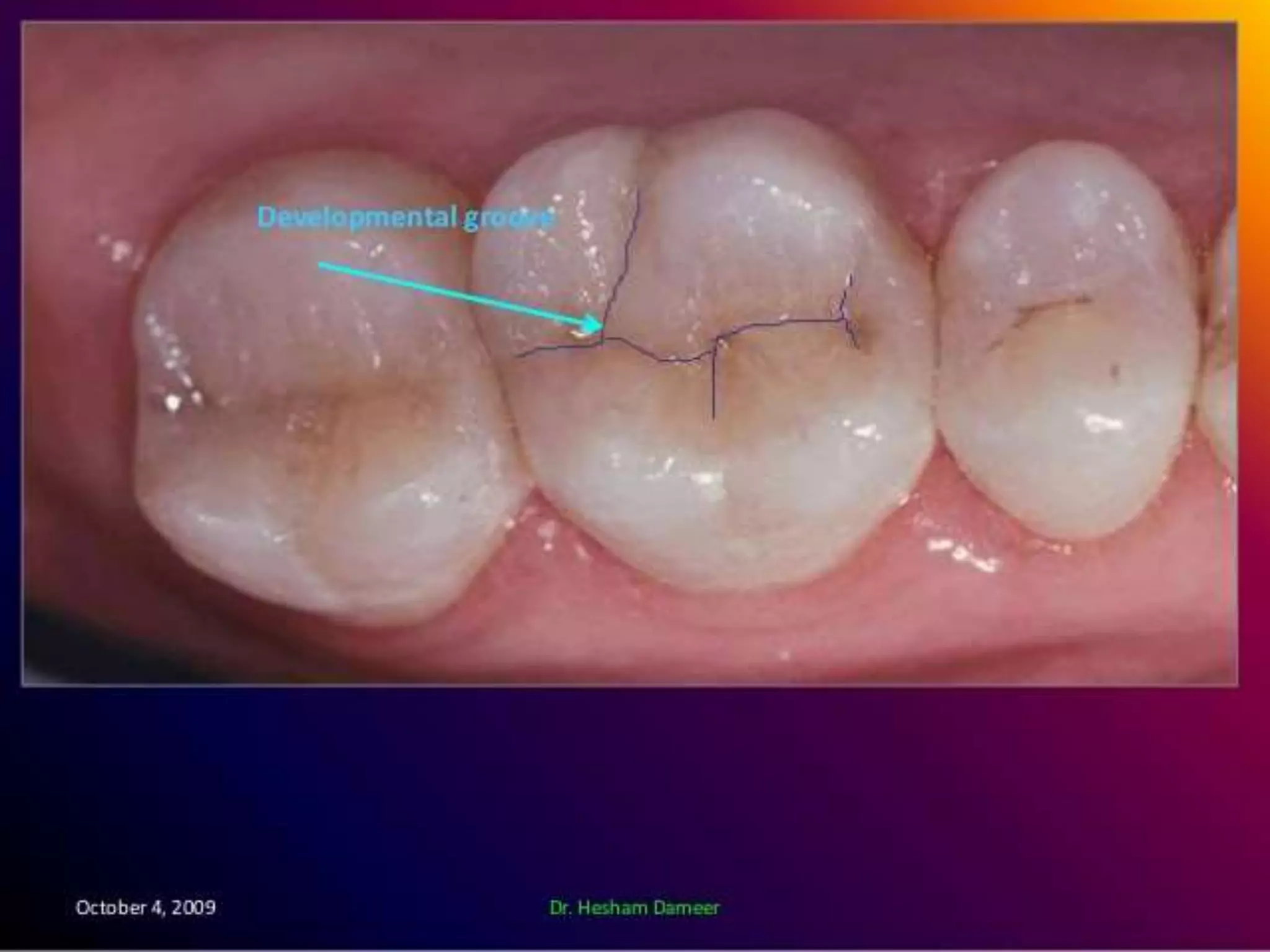 Anatomical structures of teeth | PPTX