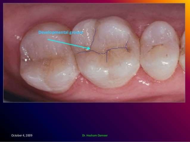 Anatomical structures of teeth | PPTX