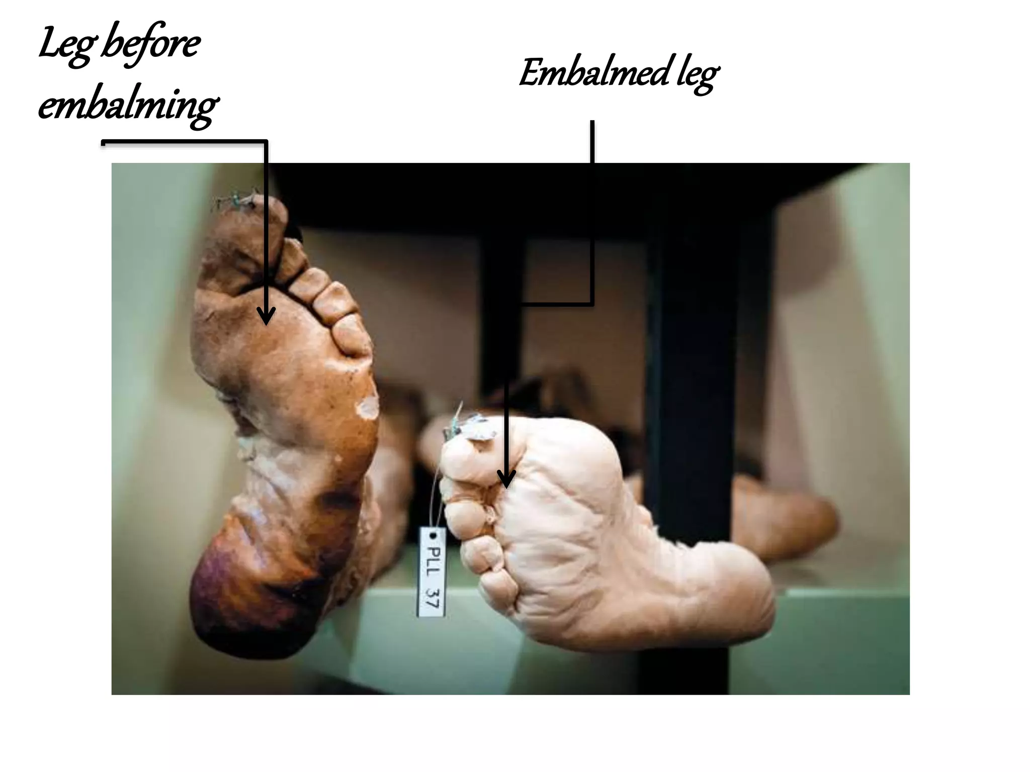Anatomical techniques | PPTX