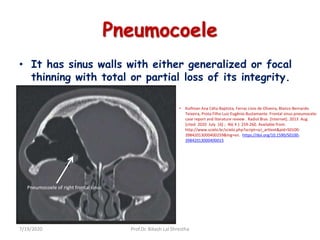 Anatomical variations in sinonasal region (ct scan overview) | PPTX