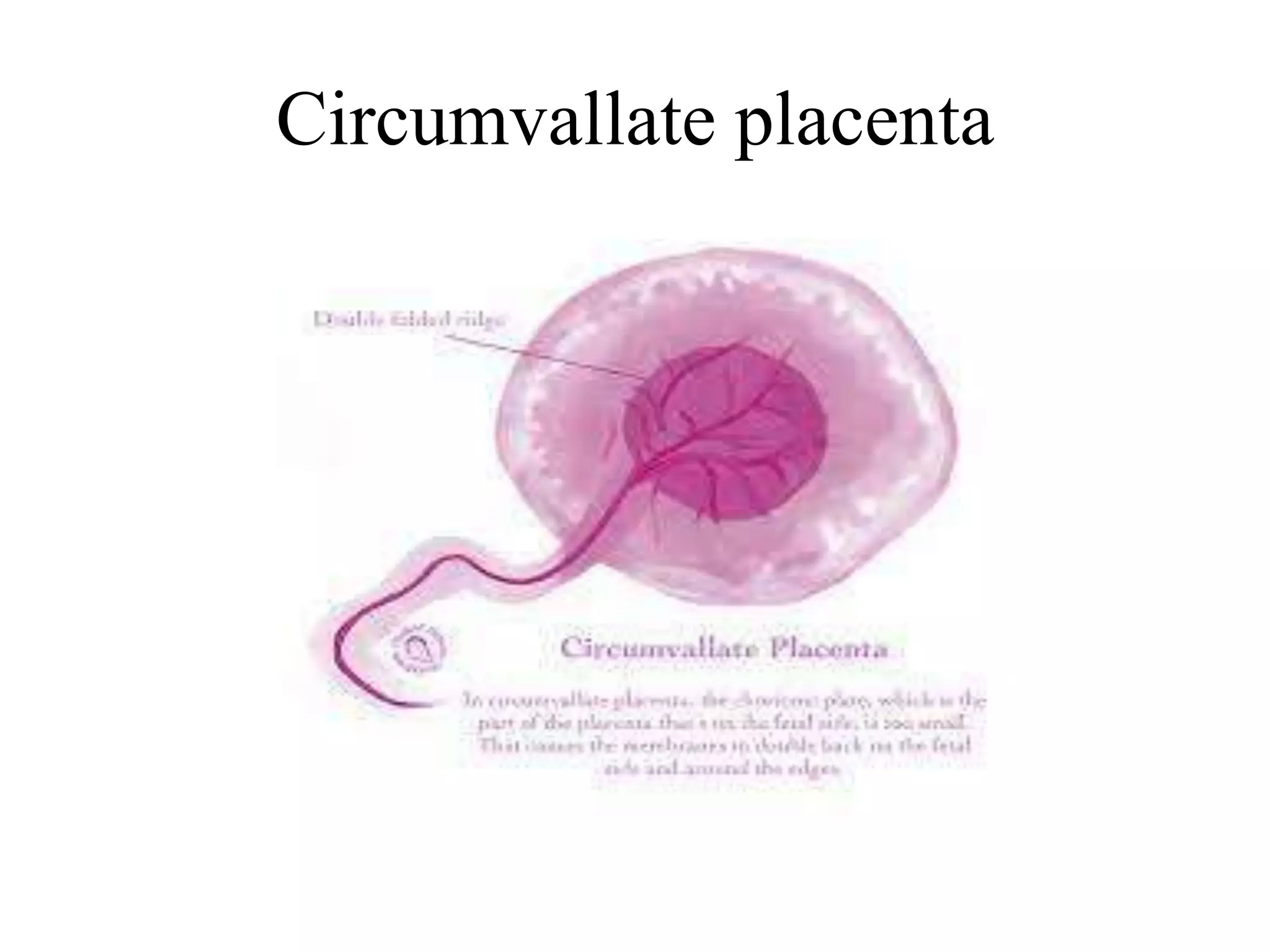 Anatomical variations of the placenta and the cord.pptx