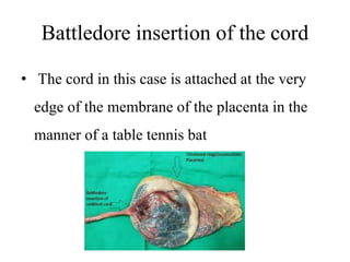 Anatomical variations of the placenta and the cord.pptx
