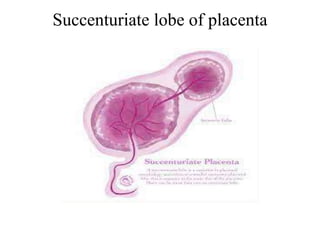 Anatomical variations of the placenta and the cord.pptx