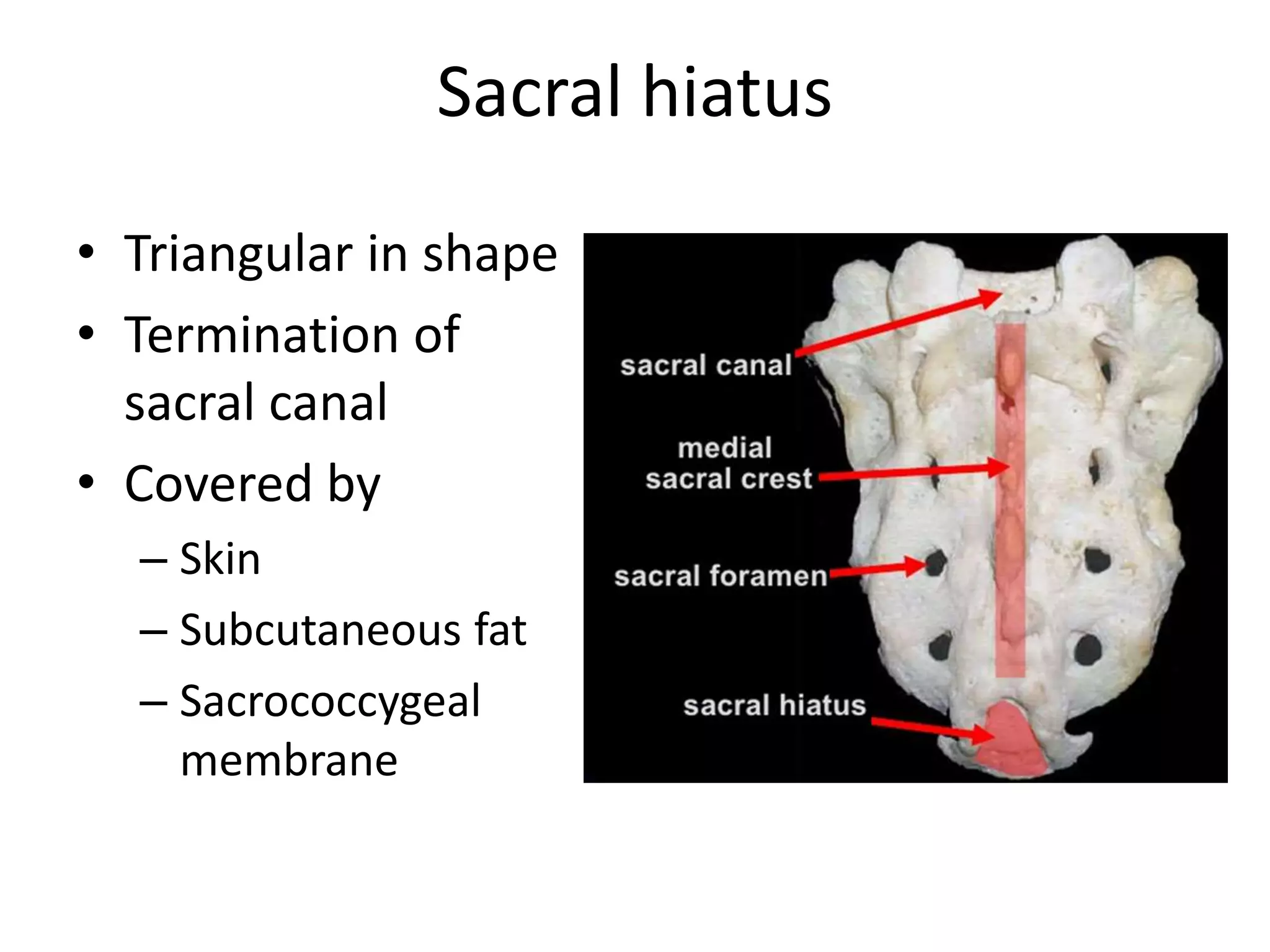 Anatomic basis of epiduroscopy | PPTX