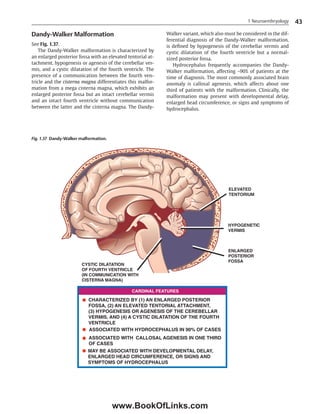 Anatomic_Basis_of_Neurologic_Diagnosis.pdf