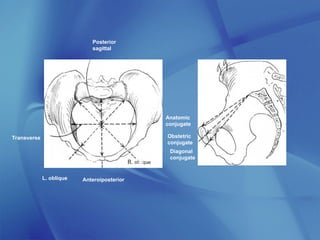 Anatomic characteristics of Fetal head and Pelvis.ppt