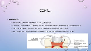 Anatomic Classification of Cavities 02.pptx