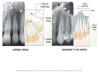 anatomiclandmarks-150504191319-conversion-gate01.pdf