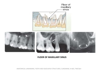 anatomiclandmarks-150504191319-conversion-gate01.pdf