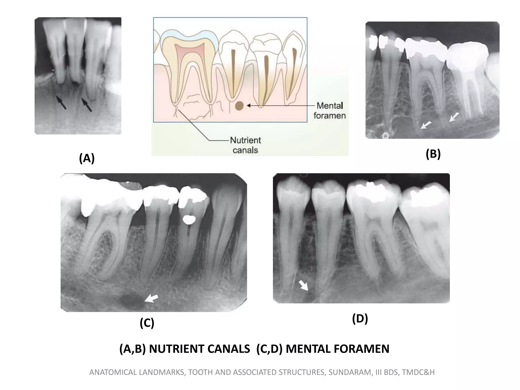 Anatomic landmarks seen in a IOPA | PPTX