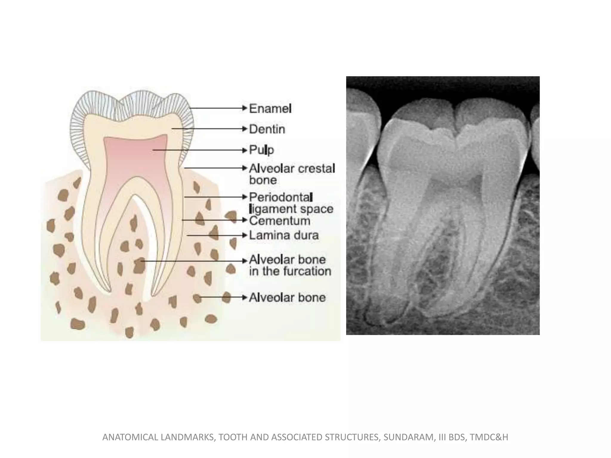 Anatomic landmarks seen in a IOPA | PPTX