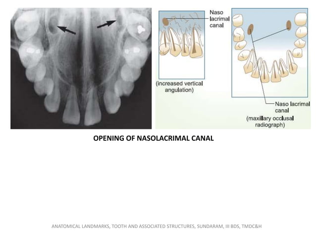 Anatomic landmarks seen in a IOPA | PPTX