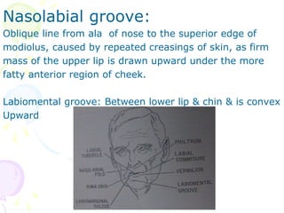 Anatomic landmarks maxilla an manible.ppt