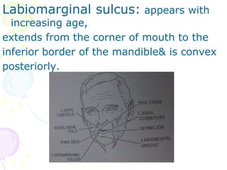 Anatomic landmarks maxilla an manible.ppt