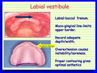 Anatomic landmarks of maxillary and mandibular arches.ppt