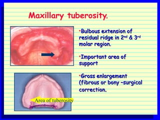 Anatomic landmarks of maxillary and mandibular arches.ppt