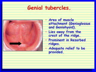 Anatomic landmarks of maxillary and mandibular arches.ppt