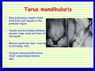 Anatomic landmarks of maxillary and mandibular arches.ppt