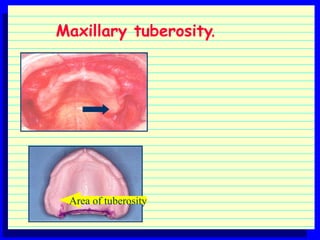 Anatomic landmarks for B.D.S students | PPT