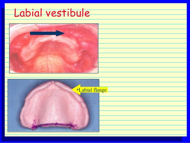 Labial Groove