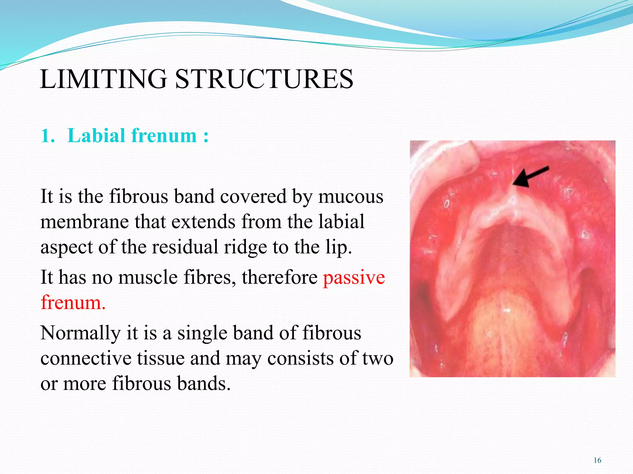 ANATOMIC LANDMARKS OF MAXILLA.pptx