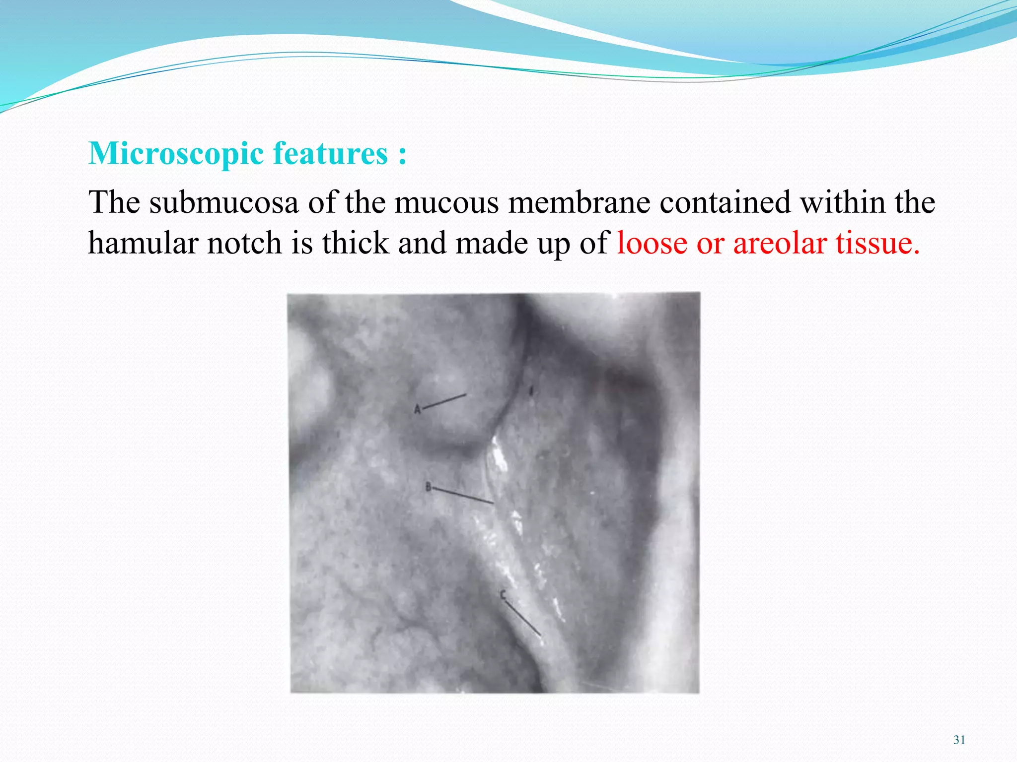ANATOMIC LANDMARKS OF MAXILLA.pptx