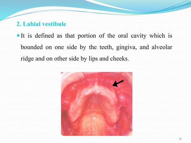 ANATOMIC LANDMARKS OF MAXILLA.pptx
