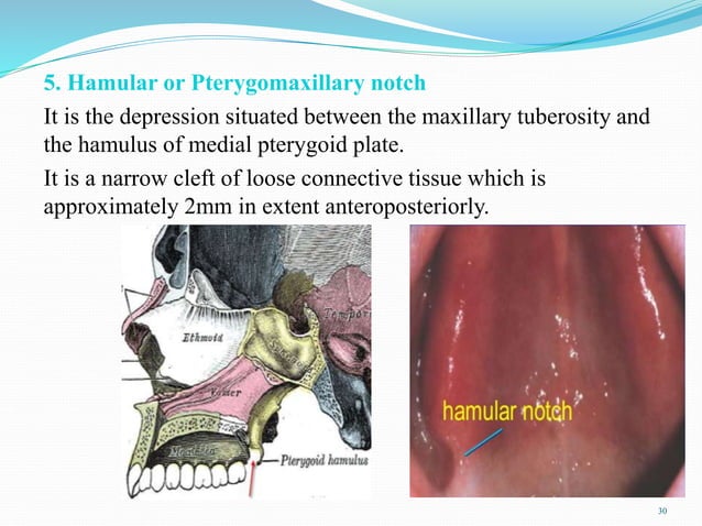 ANATOMIC LANDMARKS OF MAXILLA.pptx