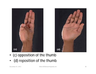 Opposition Reposition