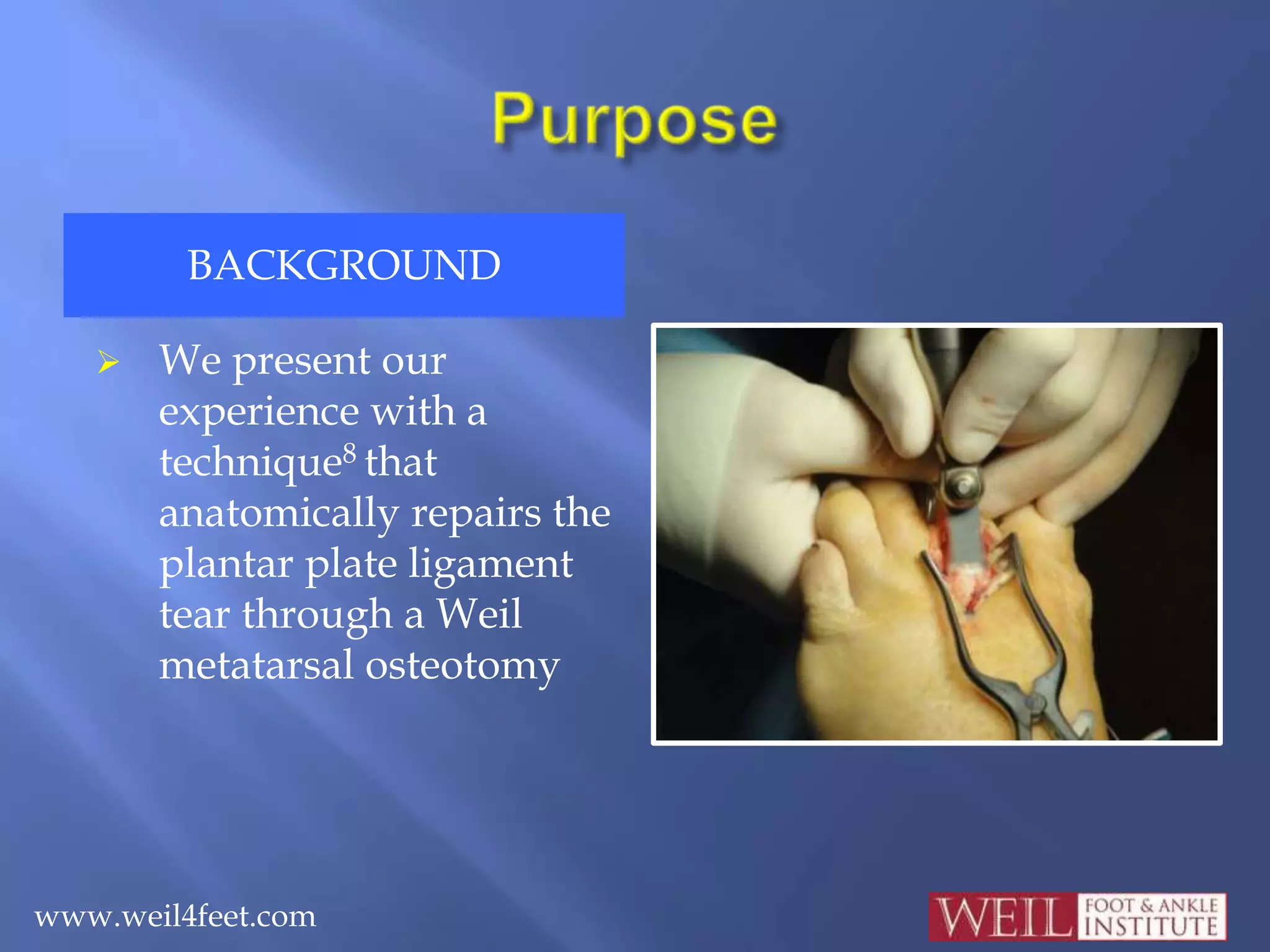 Anatomic Plantar Plate Repair | PPT